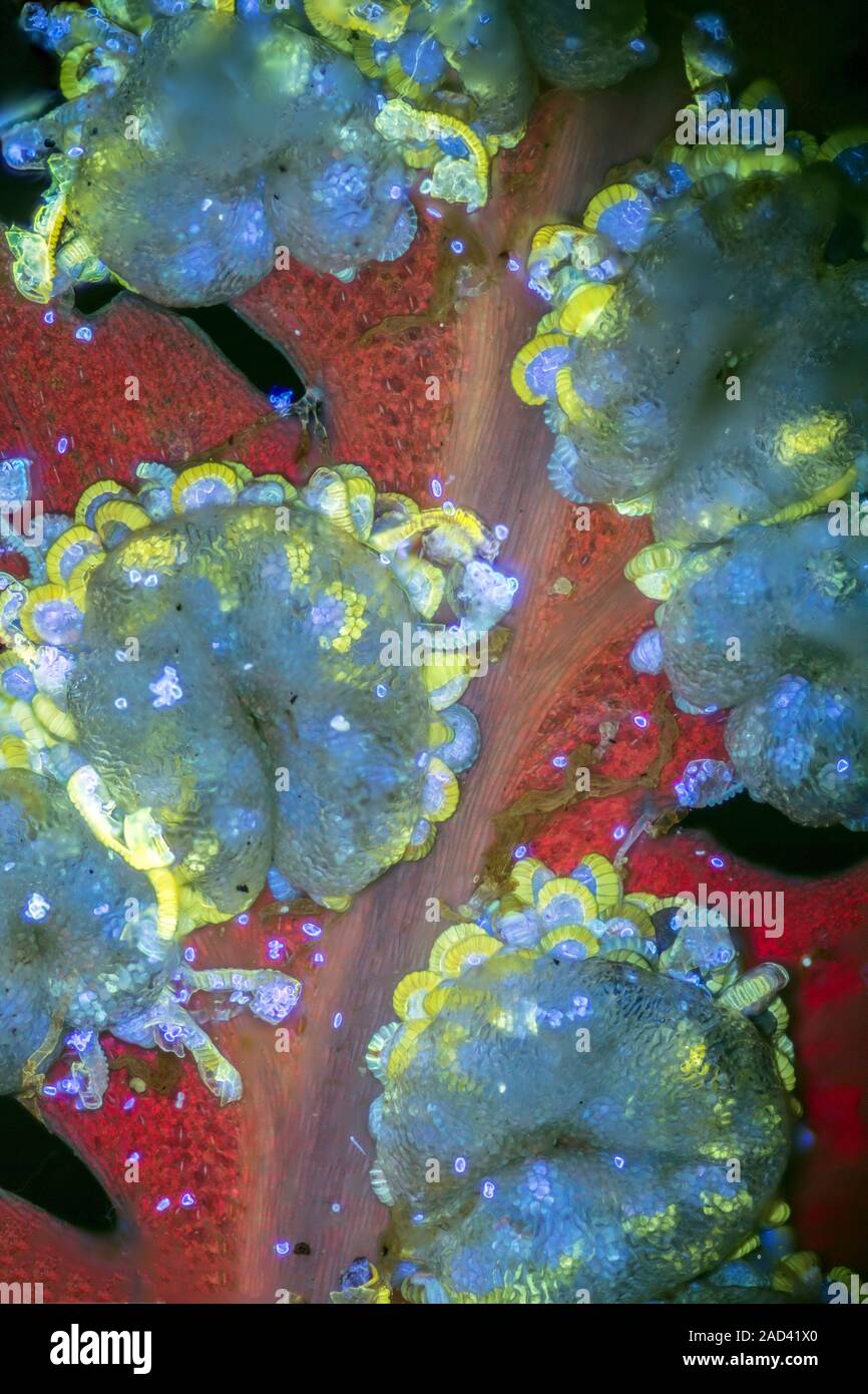 Fluorescence light micrograph of the underside of a tree fern ...