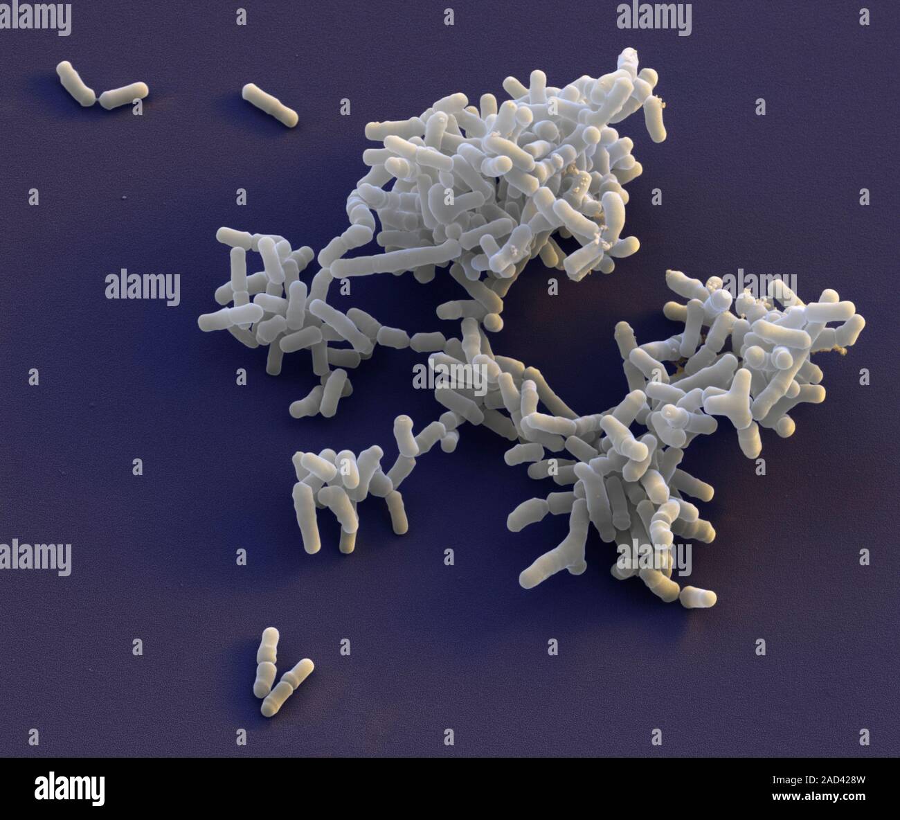 Bifidobacterium bacteria. Coloured scanning electron micrograph (SEM ...