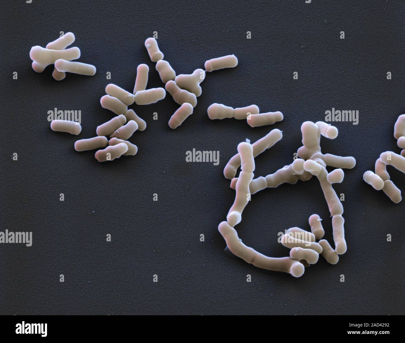 Bifidobacterium bacteria. Coloured scanning electron micrograph (SEM ...