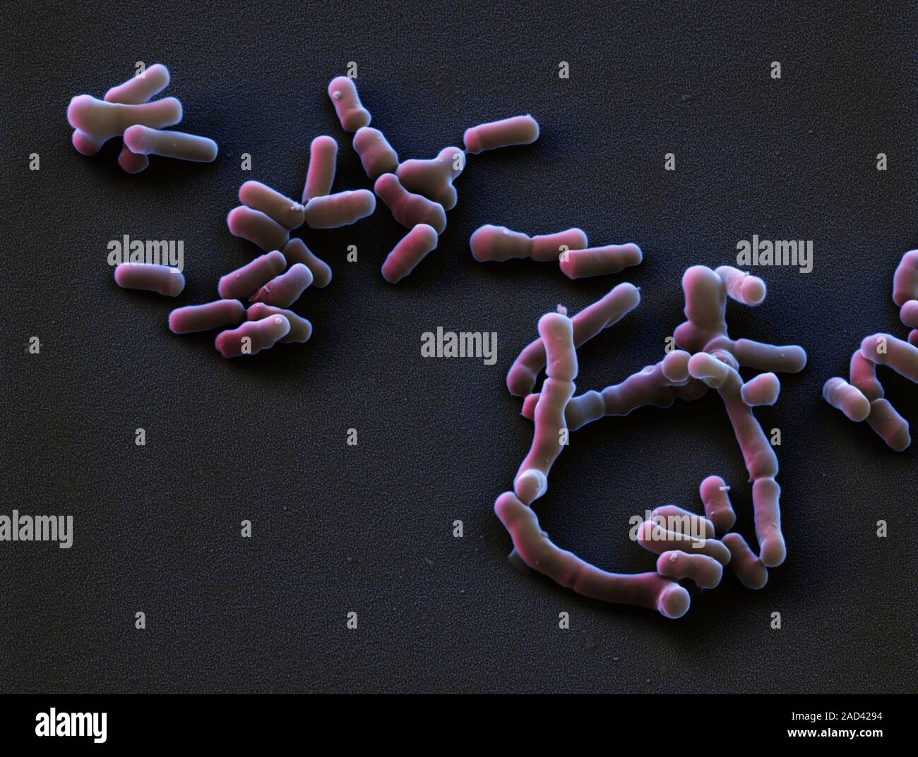 Bifidobacterium bacteria. Coloured scanning electron micrograph (SEM ...
