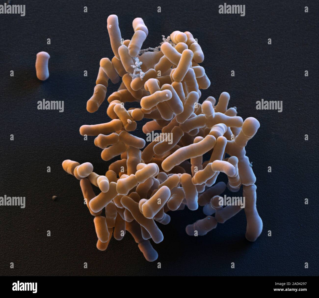Bifidobacterium bacteria. Coloured scanning electron micrograph (SEM ...