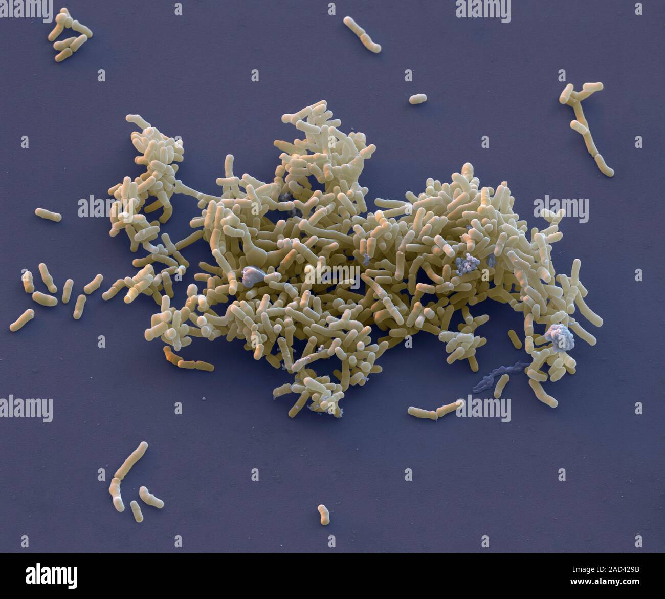 Bifidobacterium bacteria. Coloured scanning electron micrograph (SEM ...