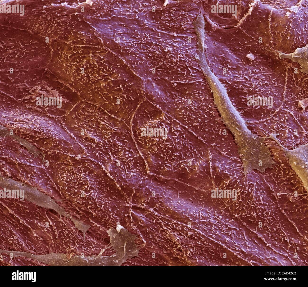 Blood vessel lining. Coloured scanning electron micrograph (SEM) of the ...