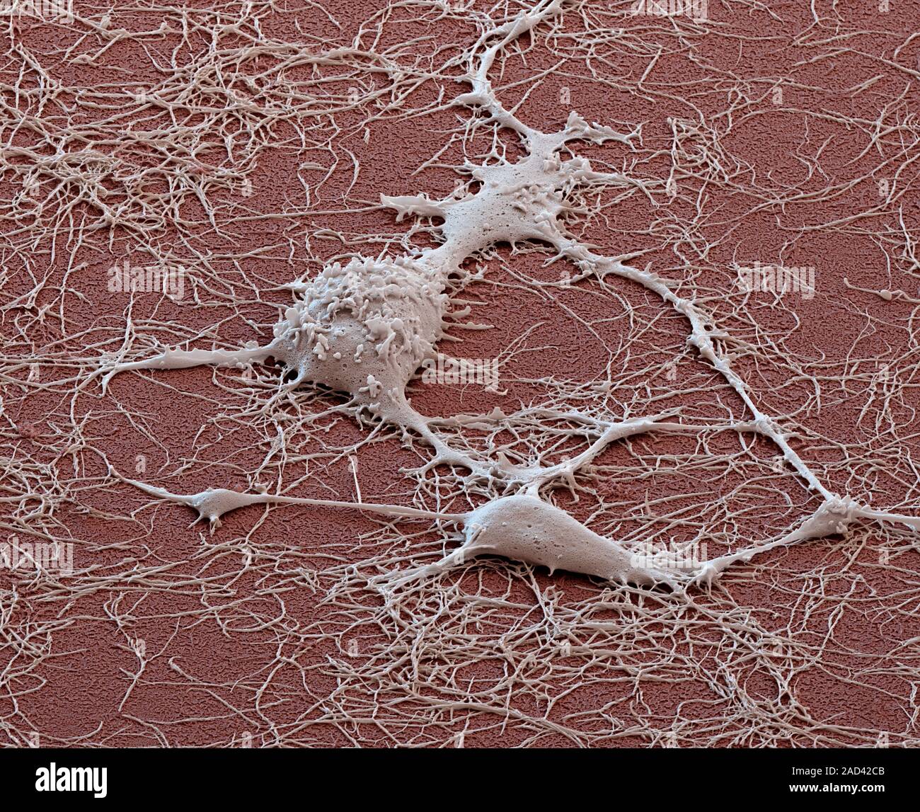Fibroblasts, coloured scanning electron micrograph (SEM). Fibroblasts ...
