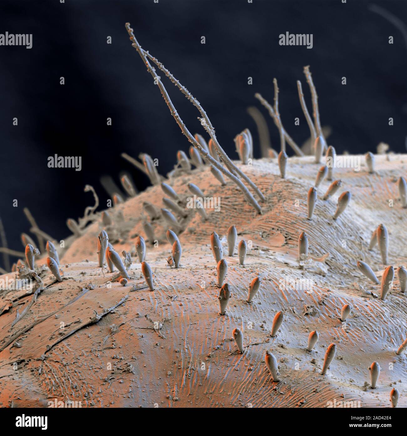 Net-winged midge (Liponeura sp.) larva. Coloured scanning electron ...