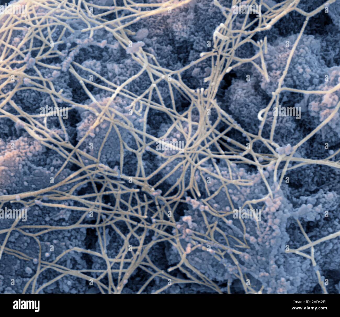 Osteoblast bone cells. Coloured scanning electron micrograph (SEM) of ...