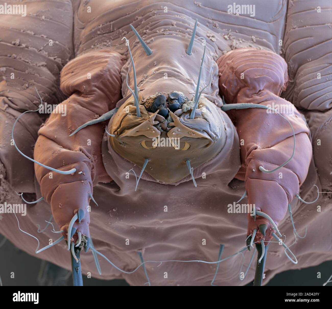 Scabies mite (Sarcoptes scabiei canis). Coloured scanning electron ...