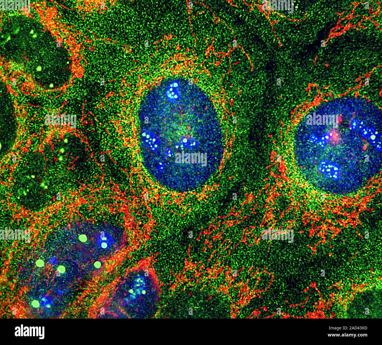 Osteosarcoma cells. Immunofluorescence light micrograph of human ...