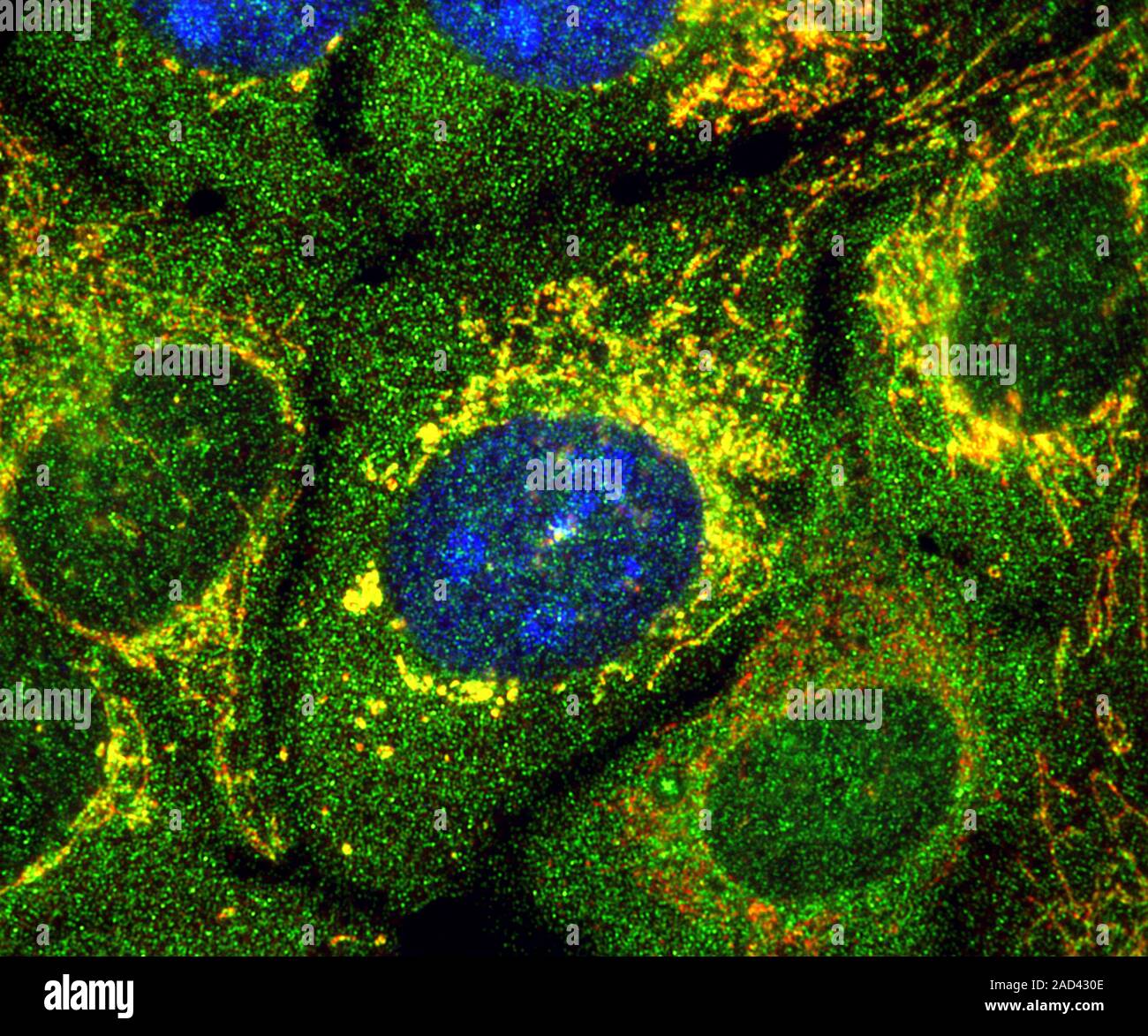 Osteosarcoma cells. Immunofluorescence light micrograph of human ...