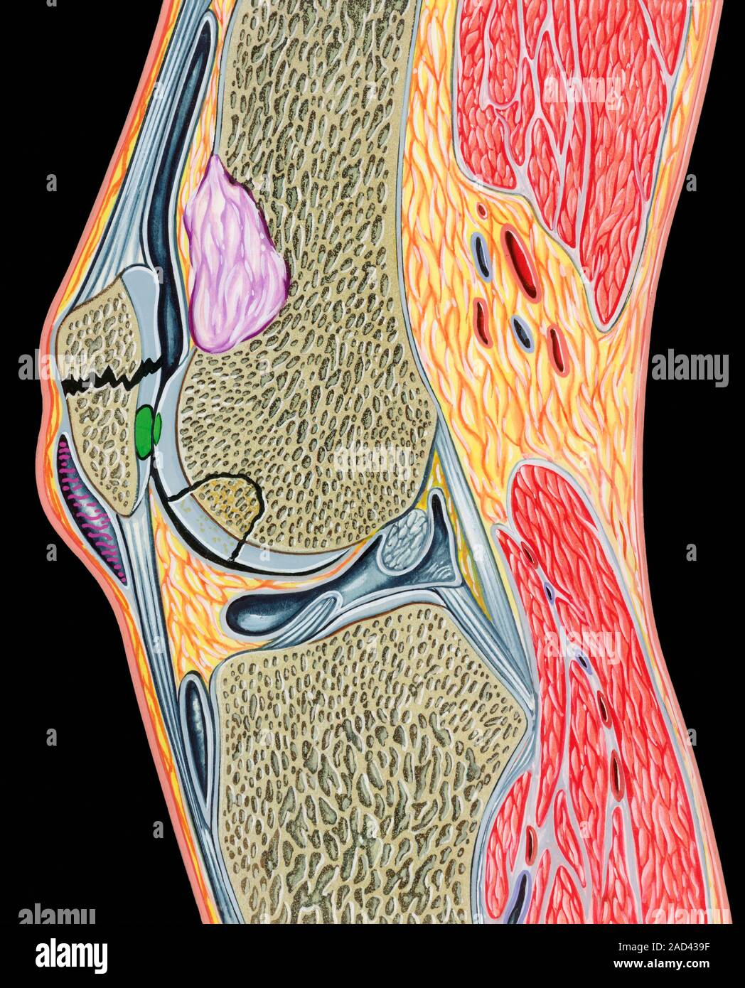 Knee Joint Disorders Illustration Of A Sagittal Section Through A Human Knee Joint Showing