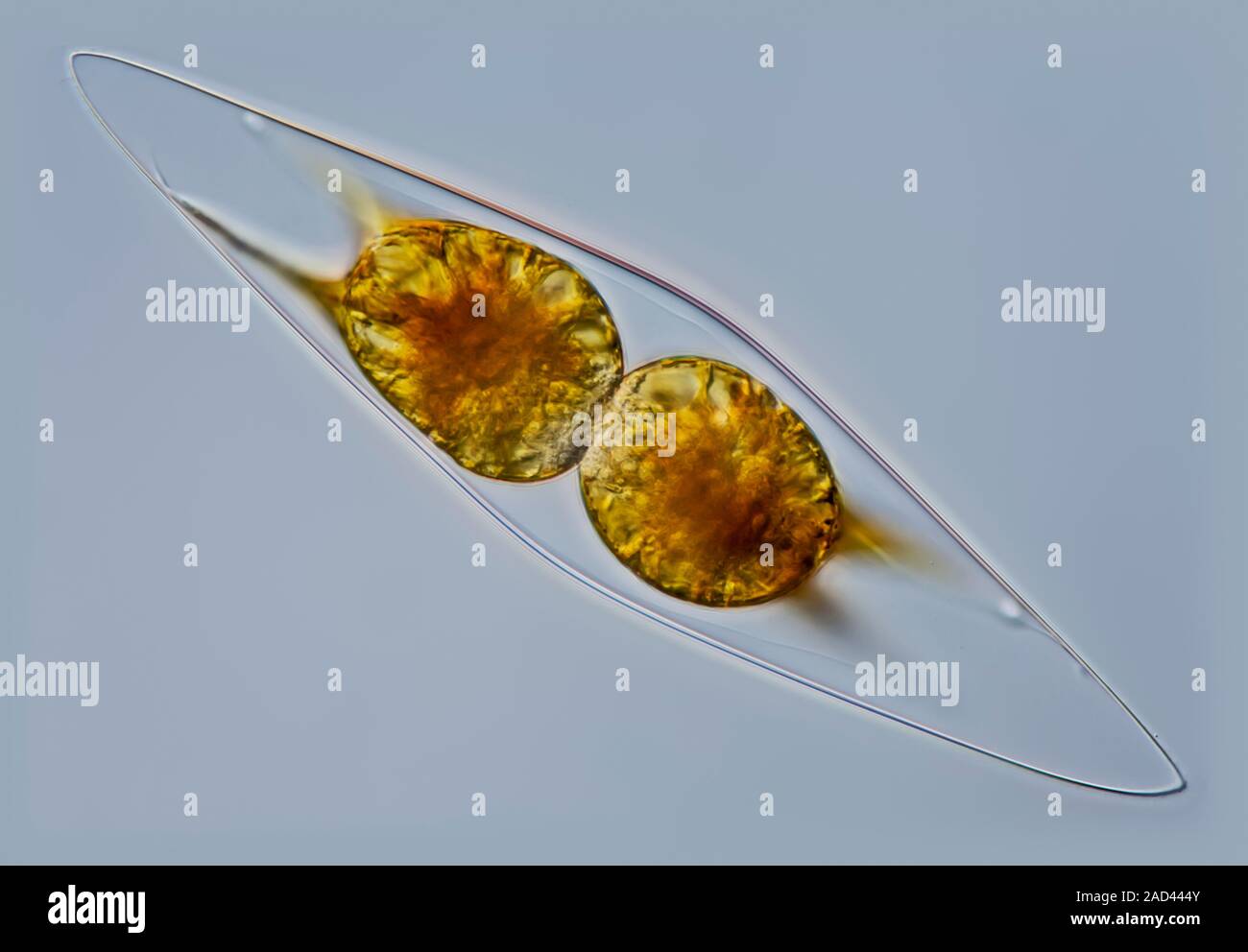 Light micrograph of Pyrocystis lunula (Gr.pyro, fire & Gr. kystis ...