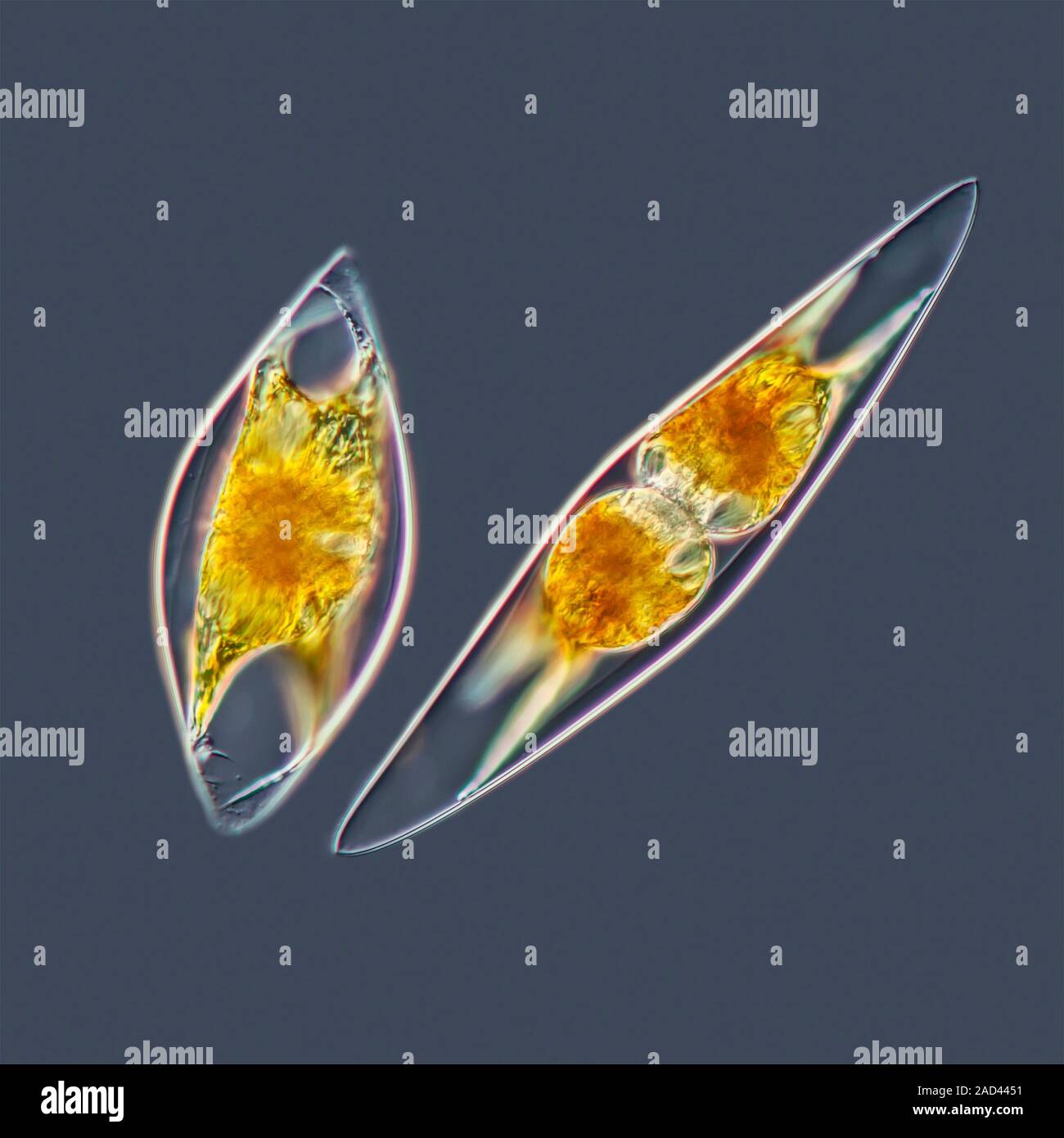 Light micrograph of Pyrocystis lunula (Gr.pyro, fire & Gr. kystis ...