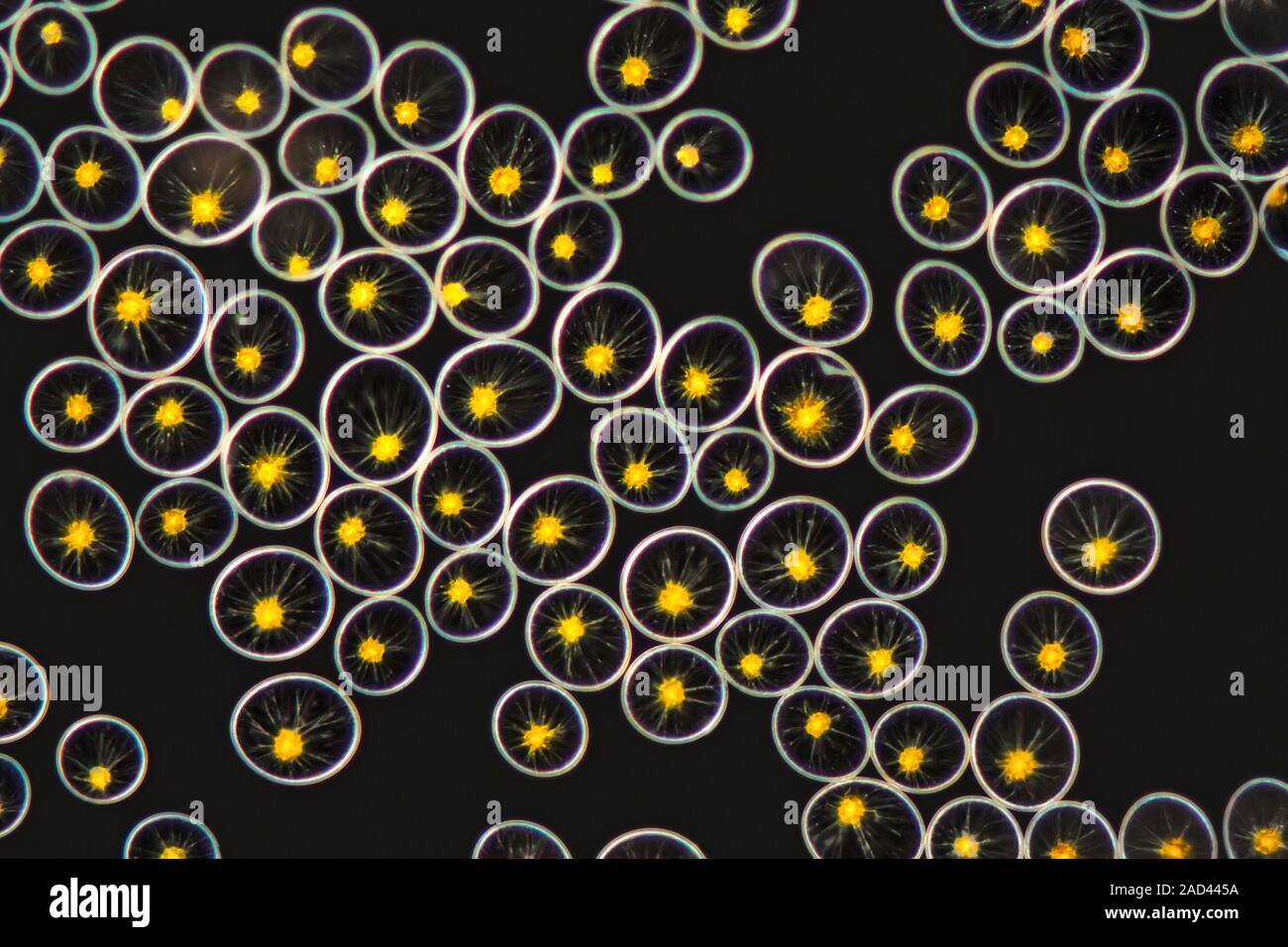 Light micrograph of Pyrocystis noctiluca(Gr.pyro, fire & Gr. kystis ...