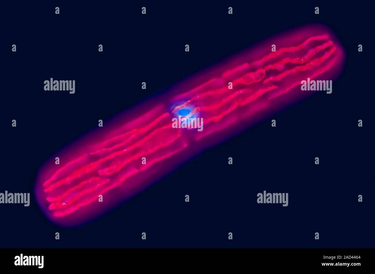 Light micrograph of a Planotaenium interruptum, a freshwater desmid ...