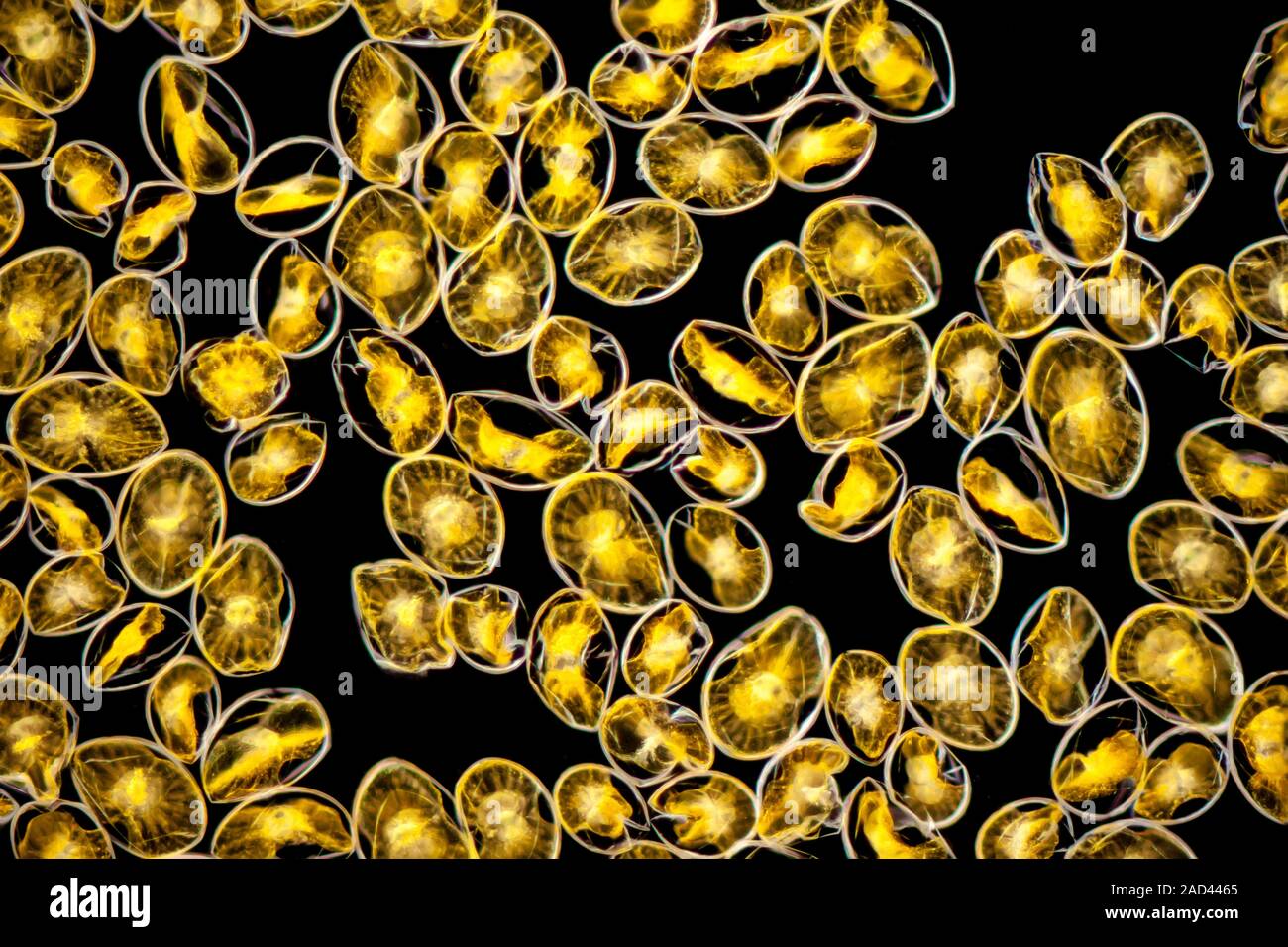 Light micrograph of Pyrocystis noctiluca(Gr.pyro, fire & Gr. kystis ...