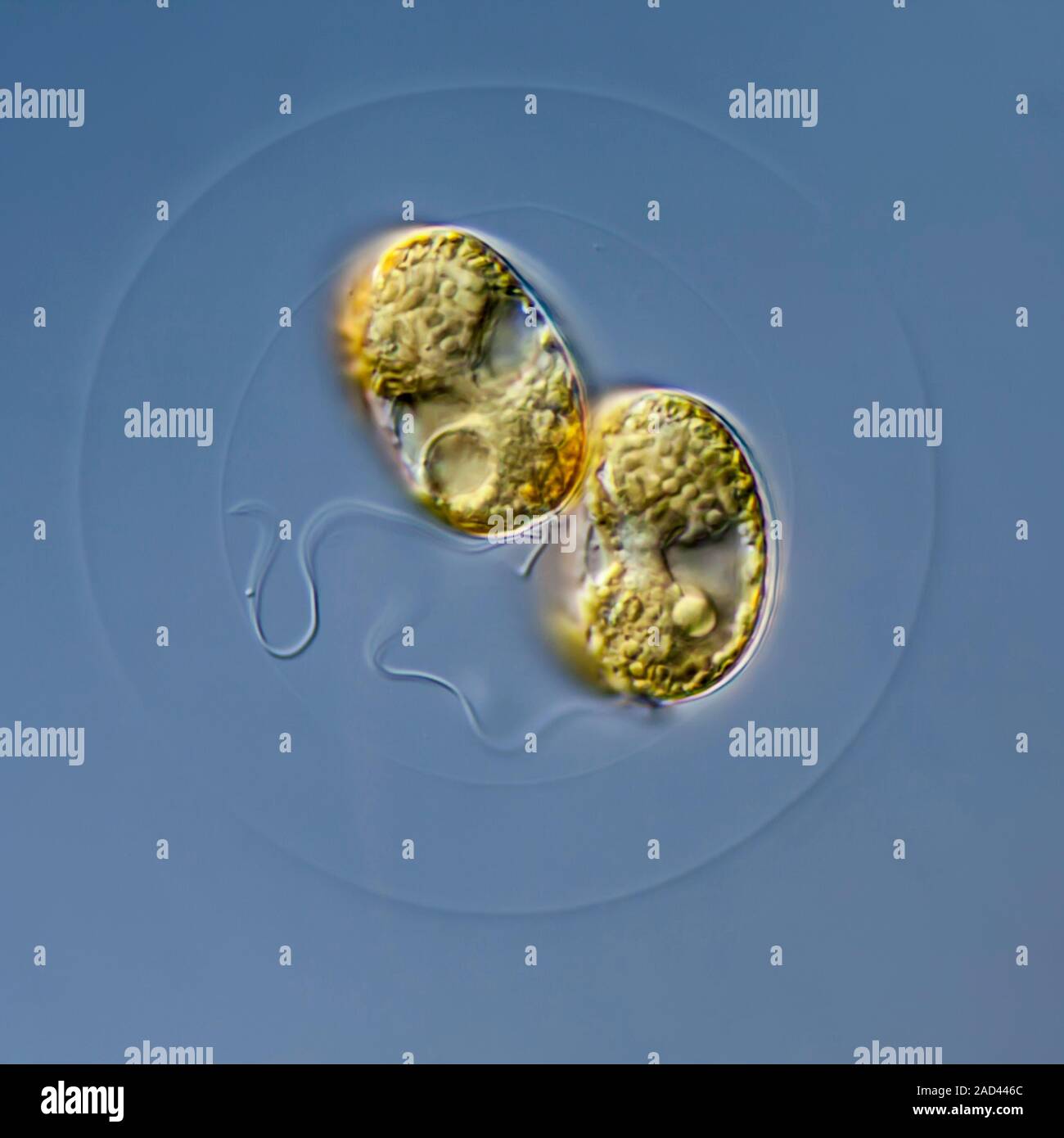 Light micrograph of Prorocentrum sp. (Gr.prora, prow & Gr. kentron ...