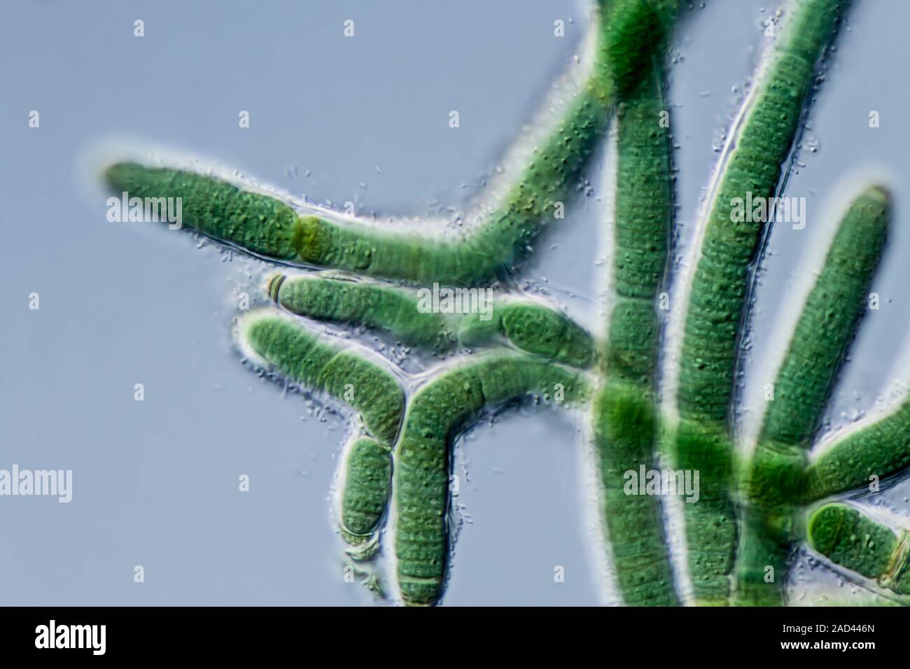 Light micrograph of Calothrix sp., a marine cyanobacterium forming ...