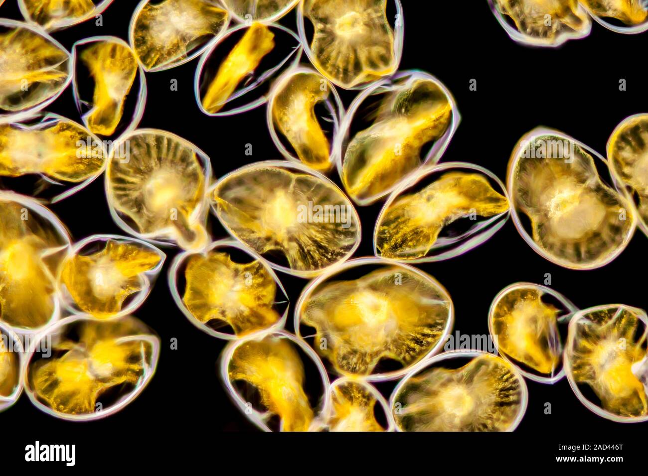 Light micrograph of Pyrocystis noctiluca(Gr.pyro, fire & Gr. kystis ...