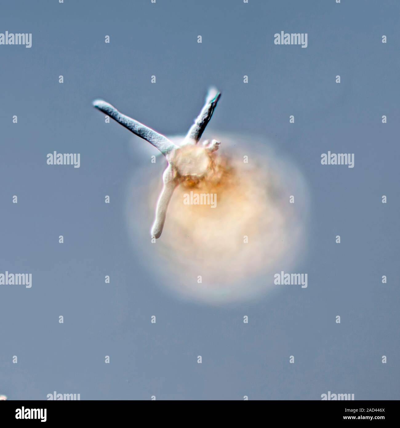 Light micrograph of Difflugia sp. testate amoeba, showing the ...