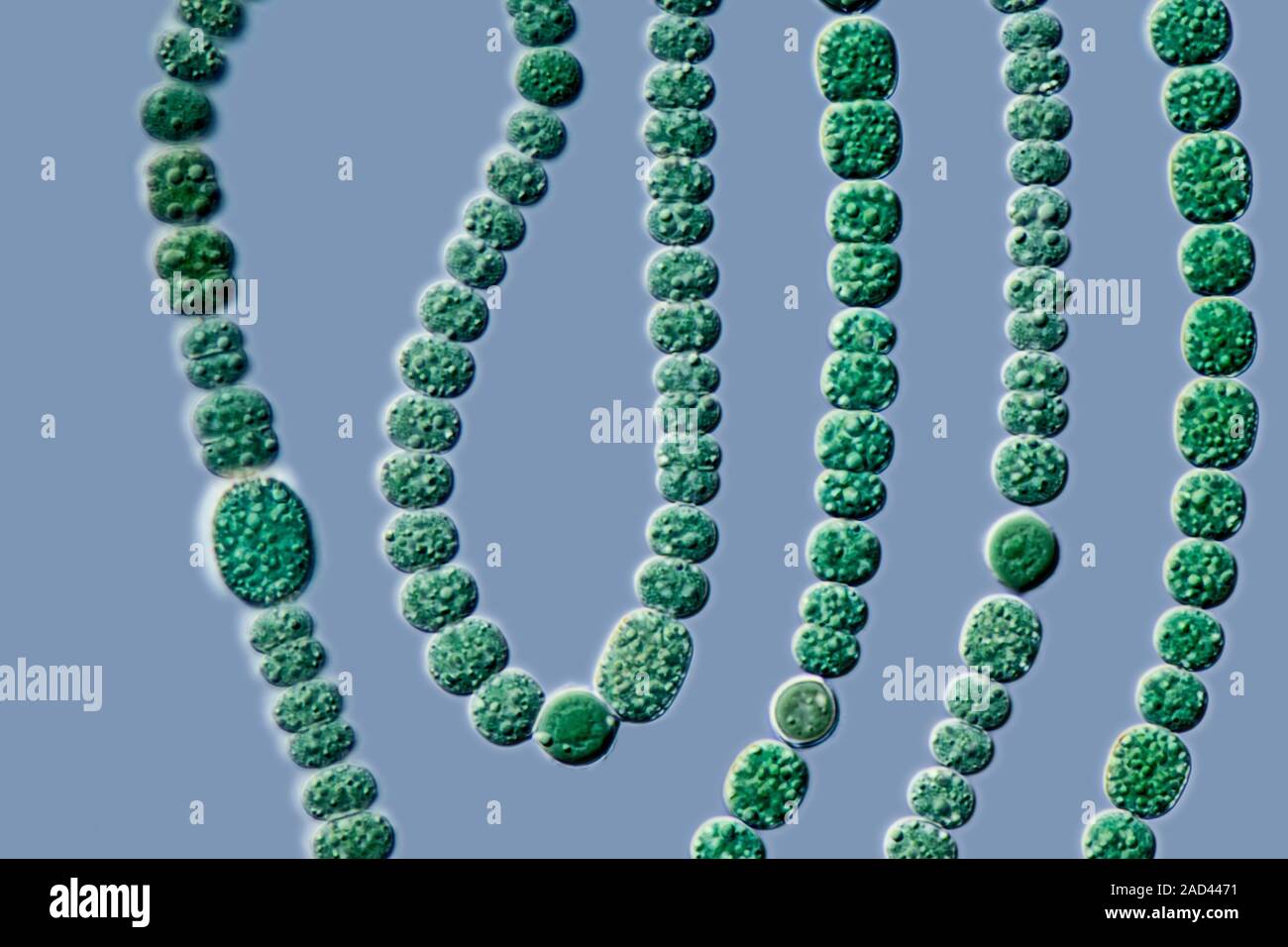 Light micrograph of Anabena sp. (Gr. anabaino, to rise), a freshwater ...