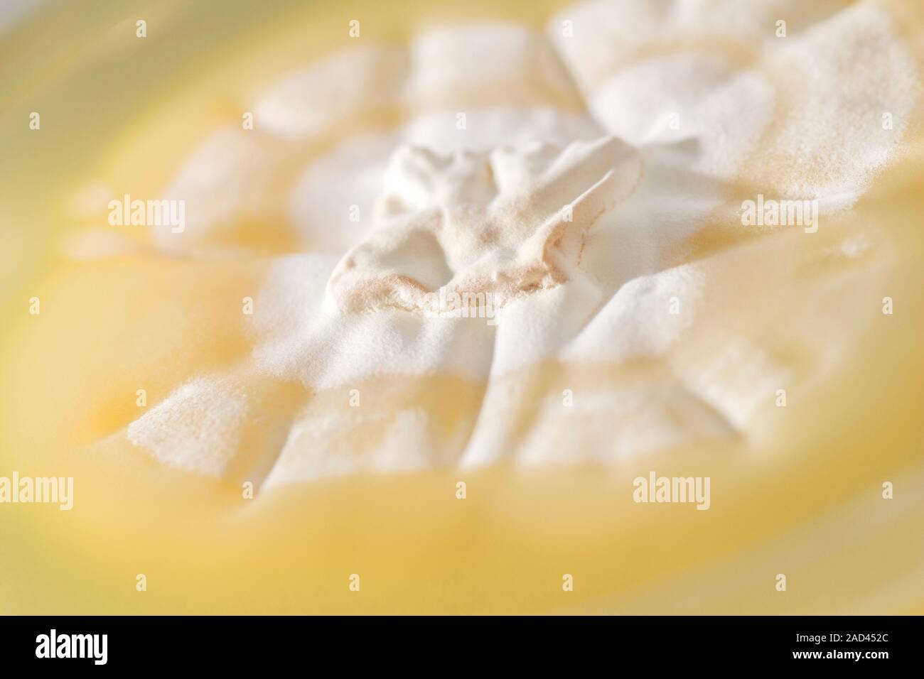 Epidermophyton floccosum fungal culture on an agar plate ...
