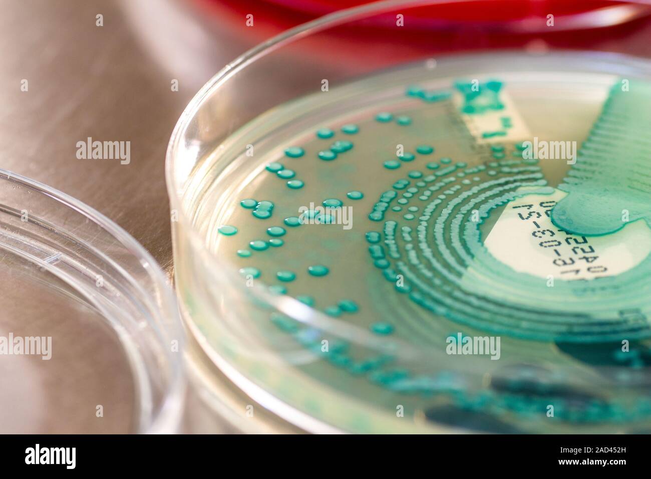 MRSA (methicillin-resistant Staphylococcus aureus) culture on a ...