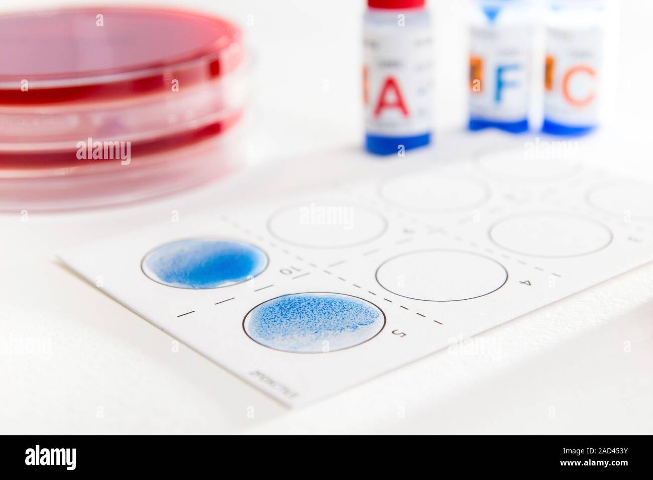 Streptococcal grouping test. The test method consists of a ...