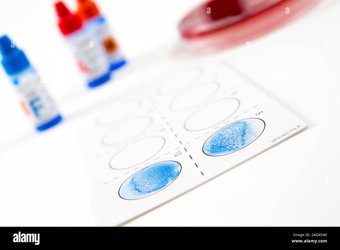 Streptococcal grouping test. The test method consists of a ...