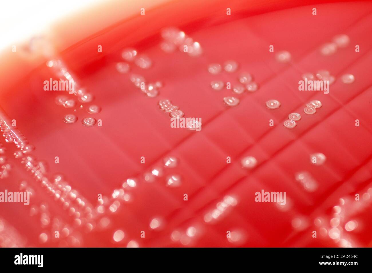 Culture of Streptococcus pyogenes (group A streptococcus) on blood agar ...