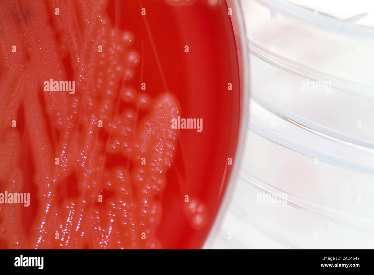 Streptococcus Agalactiae Group B Streptococcus Is A Gram Positive
