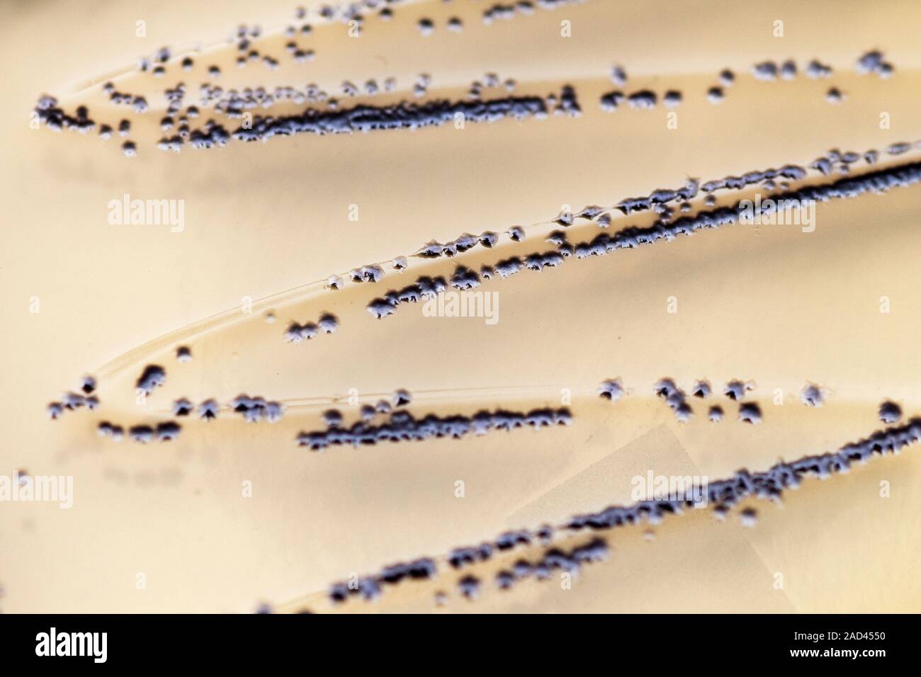 Macro image of Clostridium difficile bacteria on blood agar. C ...