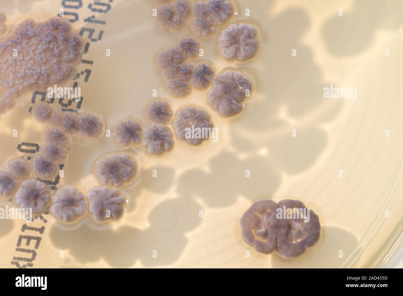 Culture of Trichosporon asahii fungi on an agar plate. Species of ...