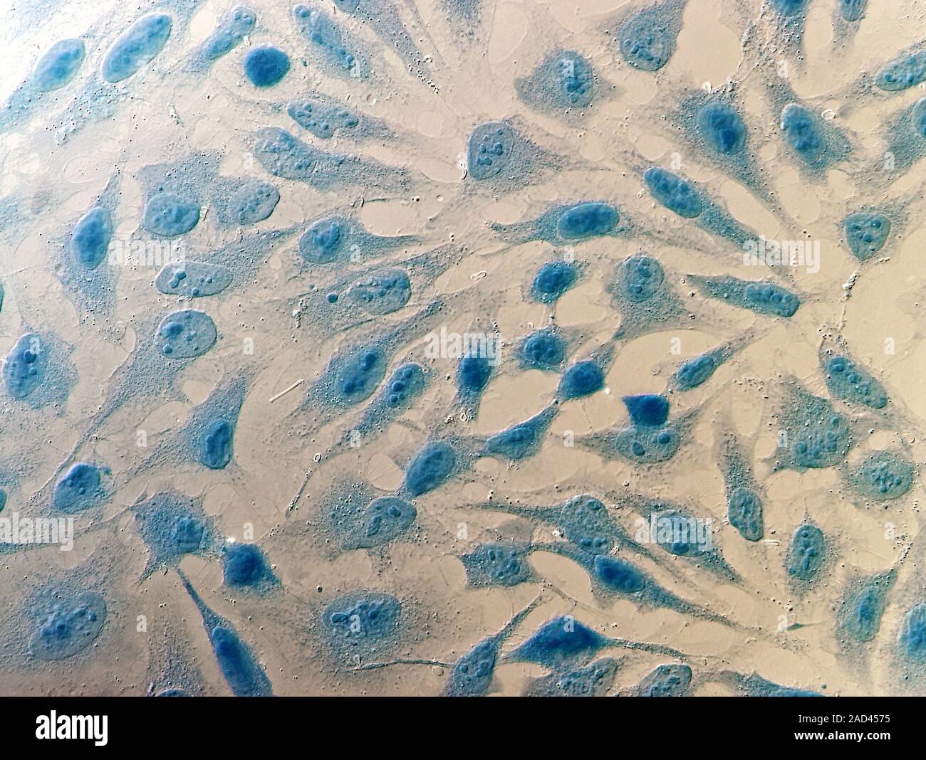 HeLa cells. Light micrograph of HeLa cells stained with Coomassie blue ...