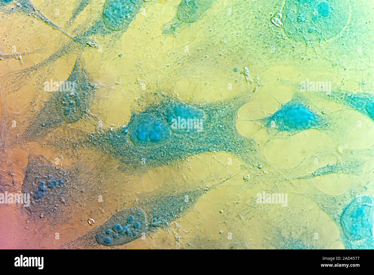 HeLa cells. Differential interference contrast (DIC) light micrograph ...