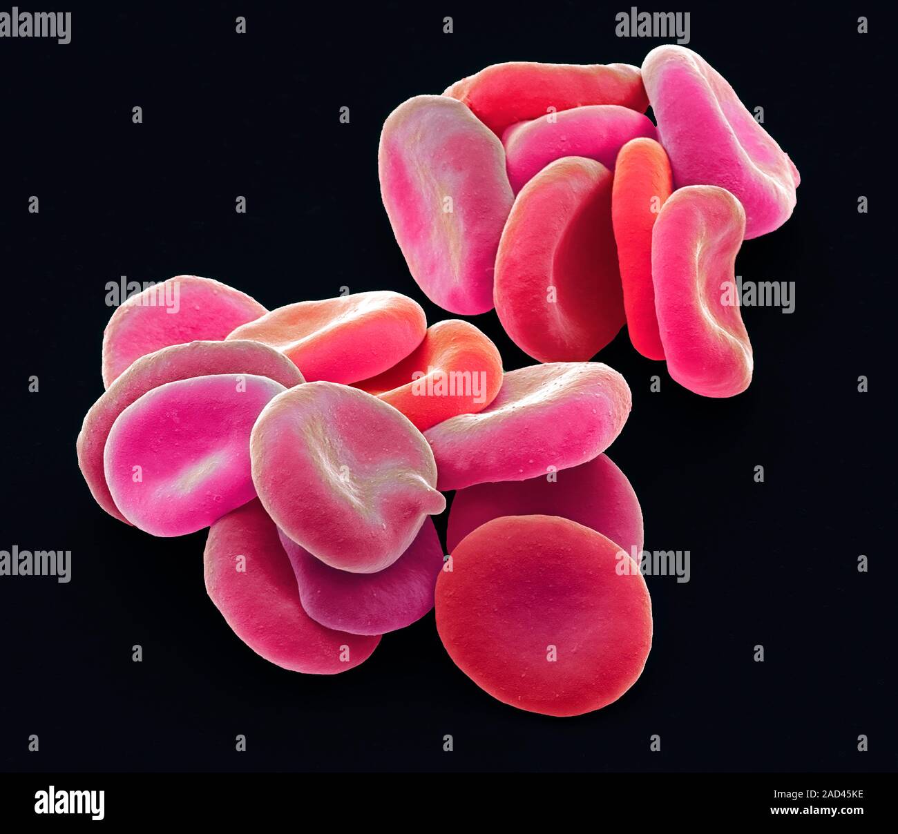 Red blood cells. Coloured scanning electron micrograph (SEM) of red ...