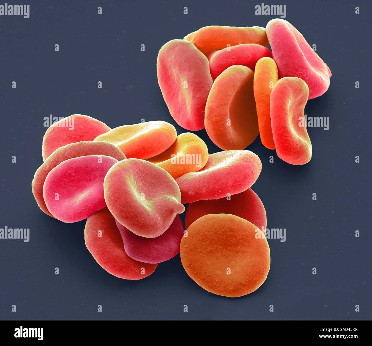 Red blood cells. Coloured scanning electron micrograph (SEM) of red ...