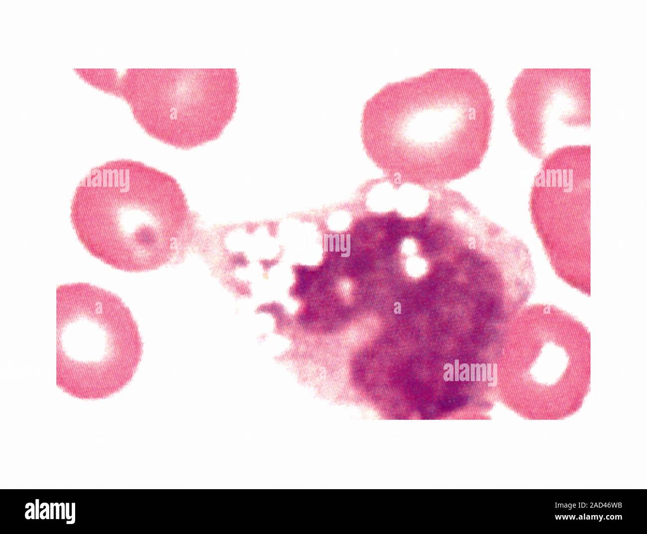 Monocyte white blood cell. This illustration is from Asklepios Atlas of ...