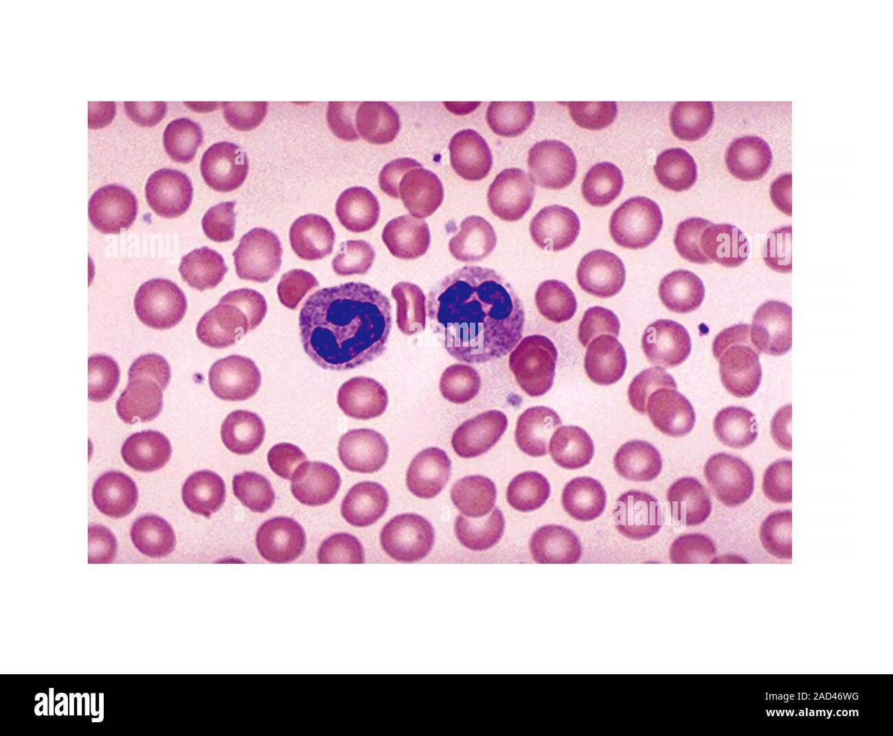Neutrophil white blood cell. This illustration is from Asklepios Atlas ...