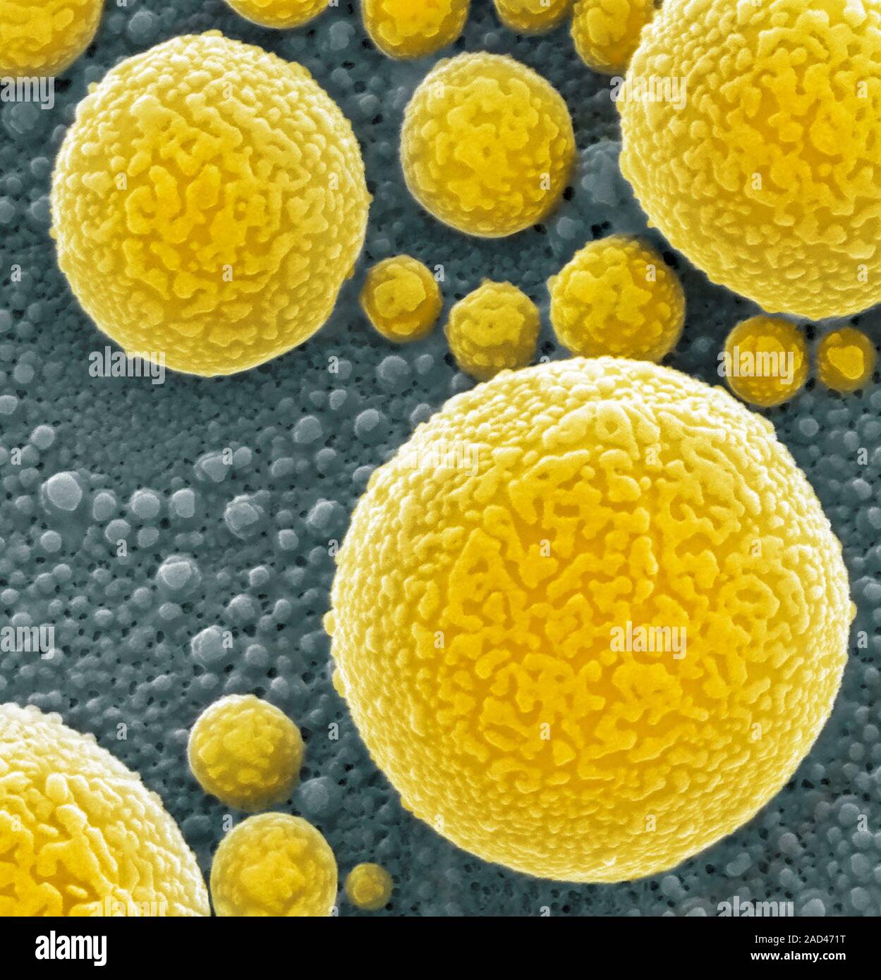 Gold atoms, helium ion microscopy. Compared to a scanning electron ...
