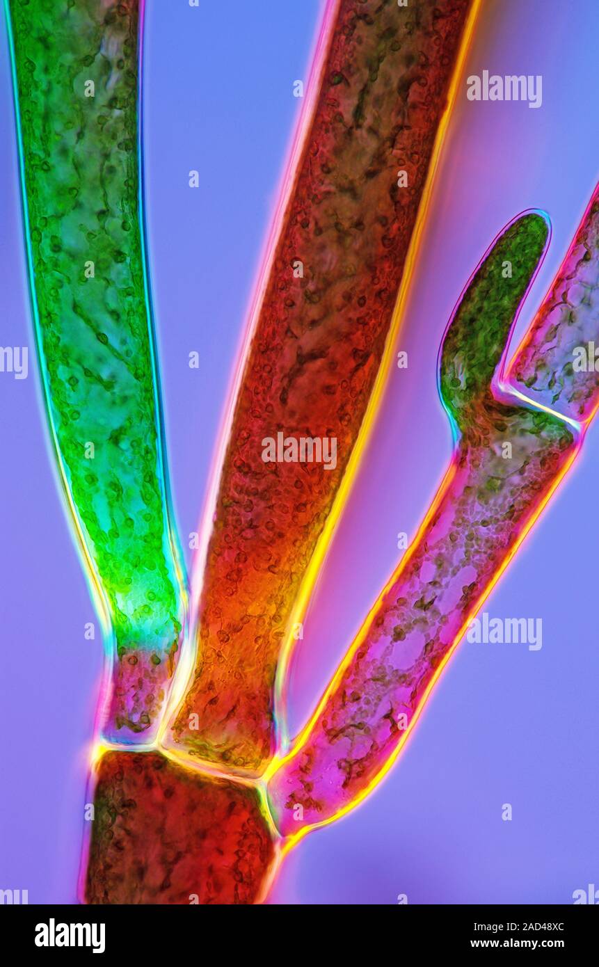 Cladophora green algae. Polarised light micrograph of Cladophora sp ...