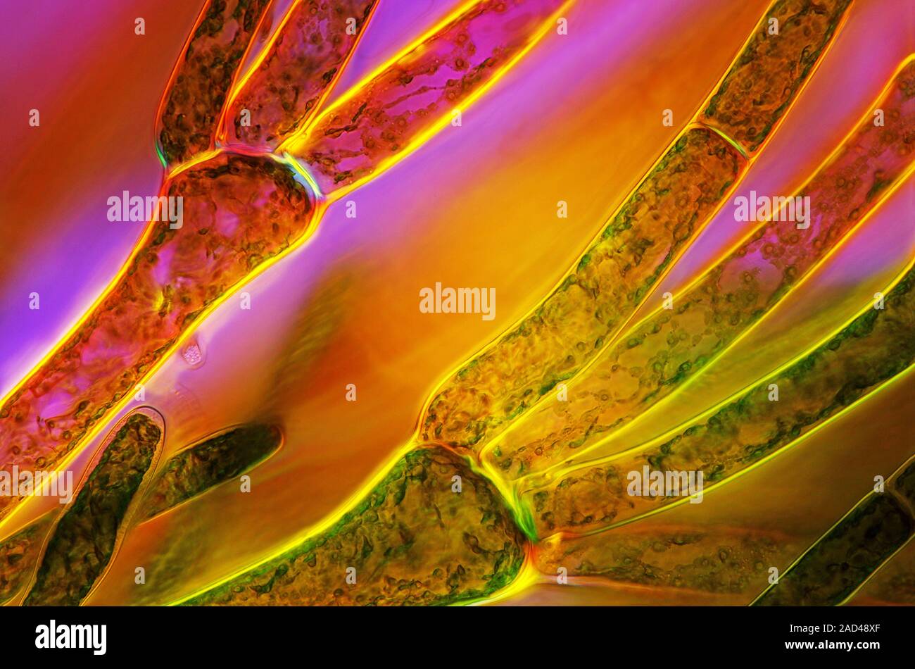 Cladophora green algae. Polarised light micrograph of Cladophora sp ...