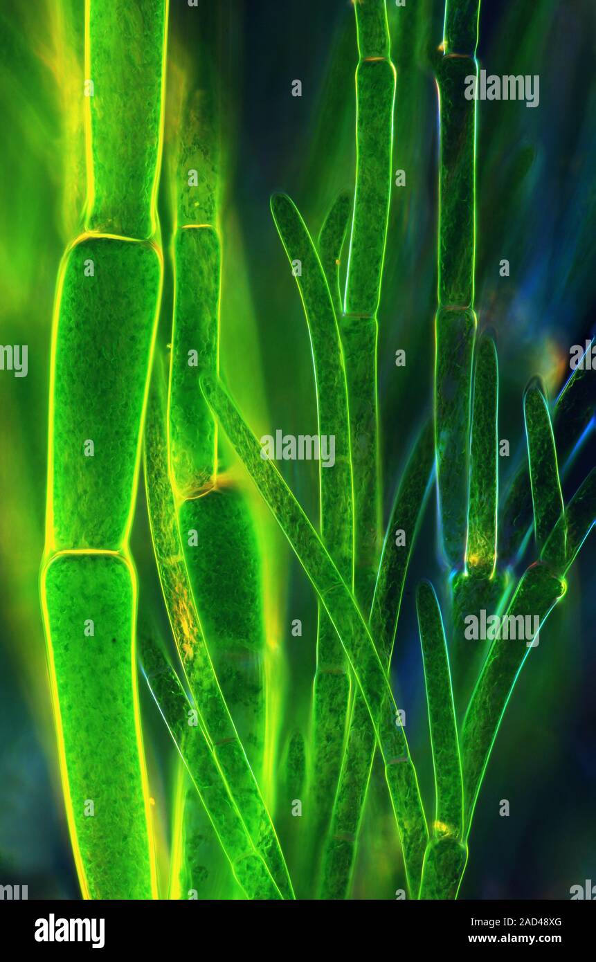 Cladophora green algae. Polarised light micrograph of Cladophora sp ...