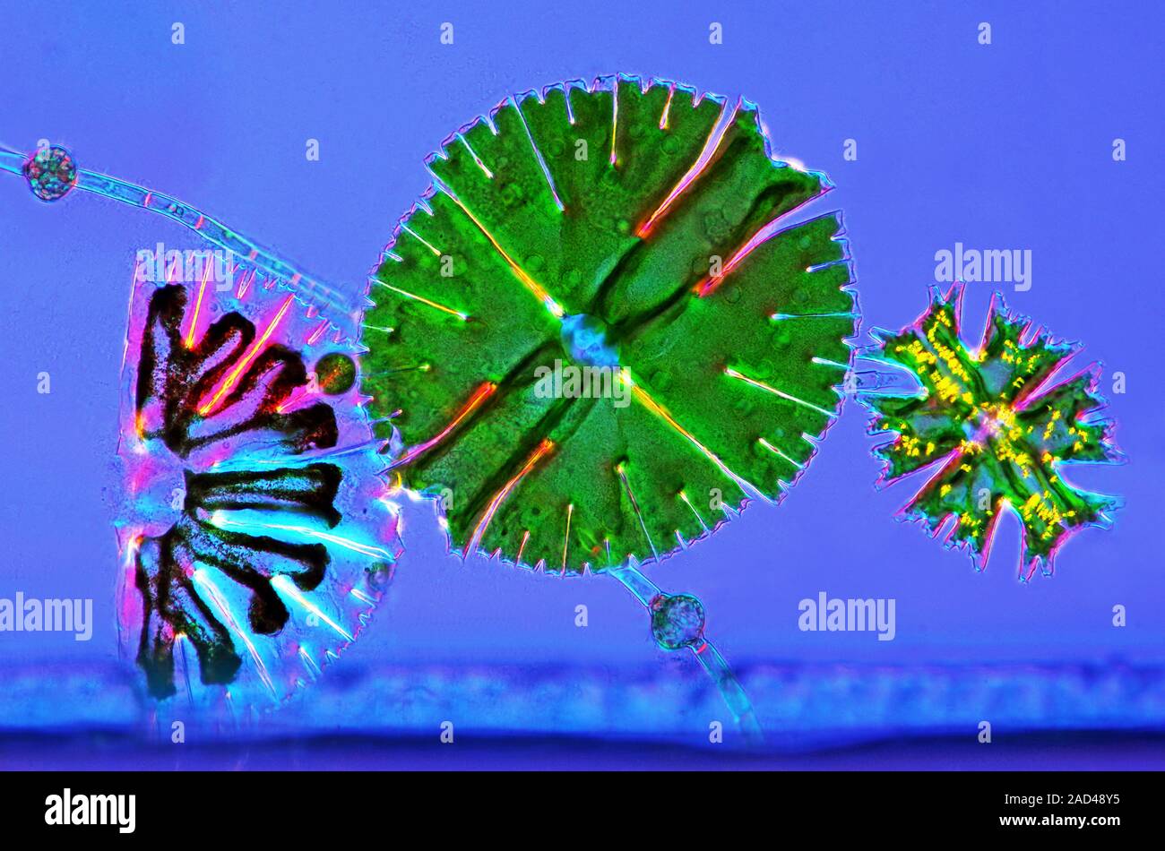 Micrasterias desmids. Polarised light micrograph of Micrasterias rotata ...