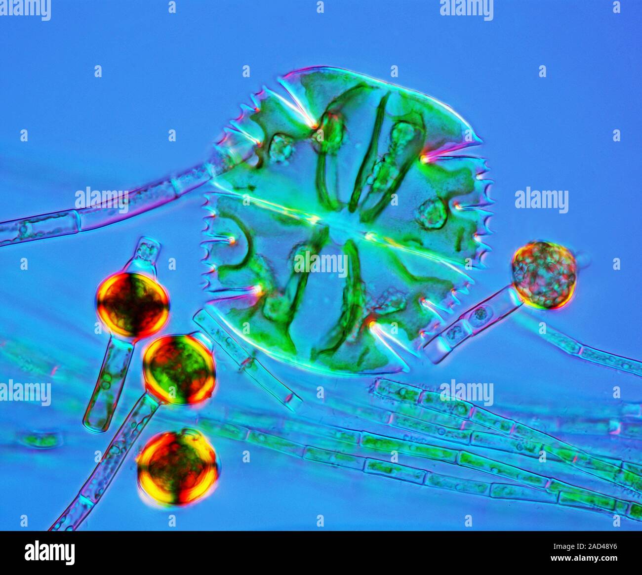 Desmids and green algae. Polarised light micrograph of Micrasterias ...