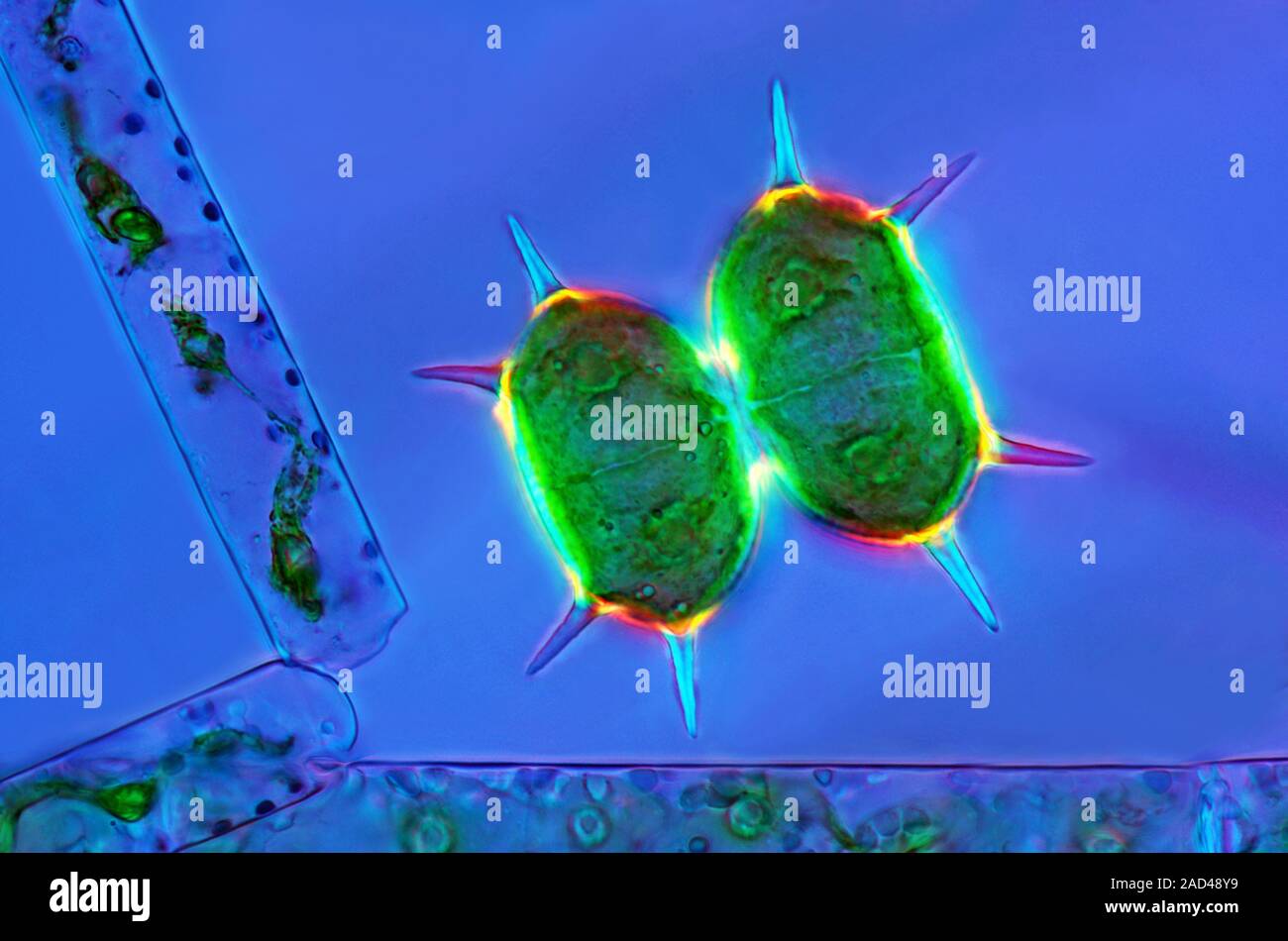 Desmids and green algae. Polarised light micrograph of Xanthidium ...