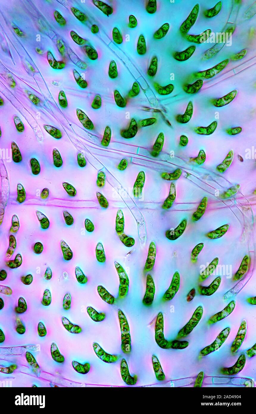 Draparnaldia green algae. Polarised light micrograph of a colony of ...