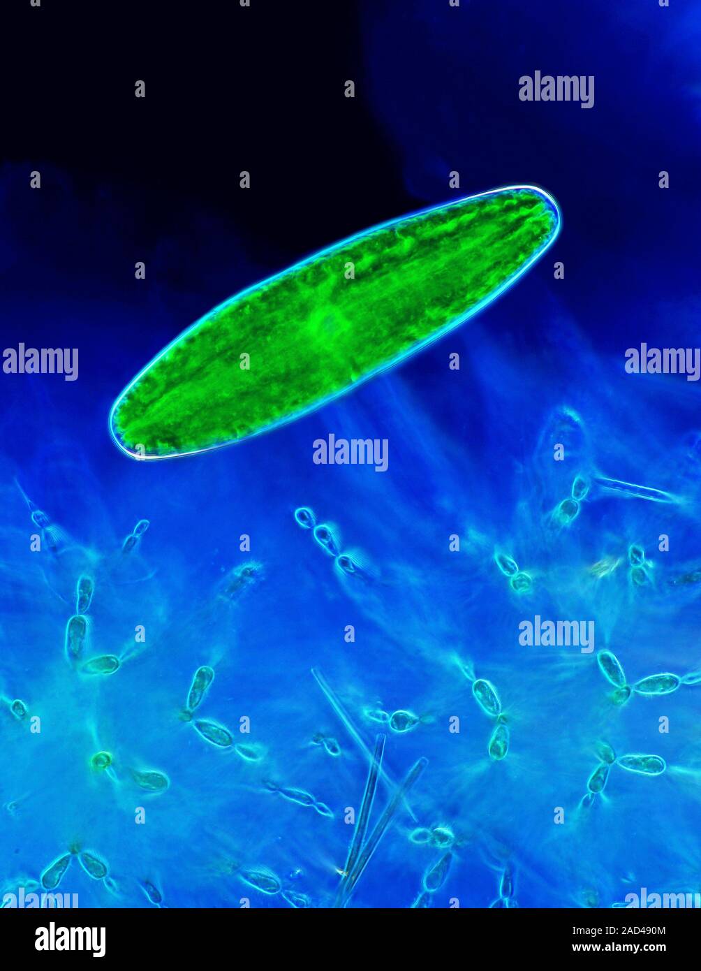 Desmid and red algae. Darkfield illuminated polarised light micrograph ...
