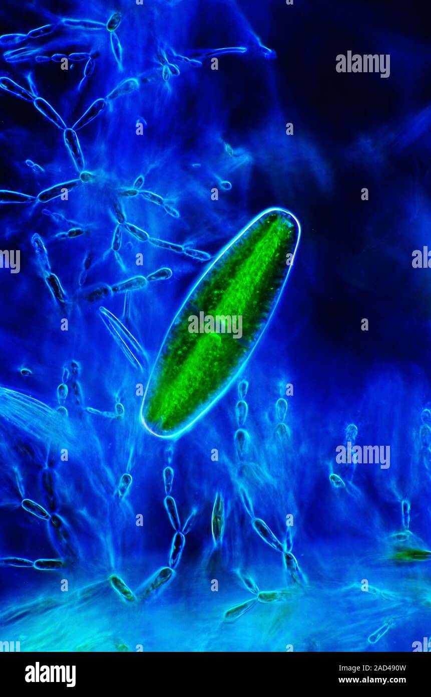 Desmid and red algae. Darkfield illuminated polarised light micrograph ...