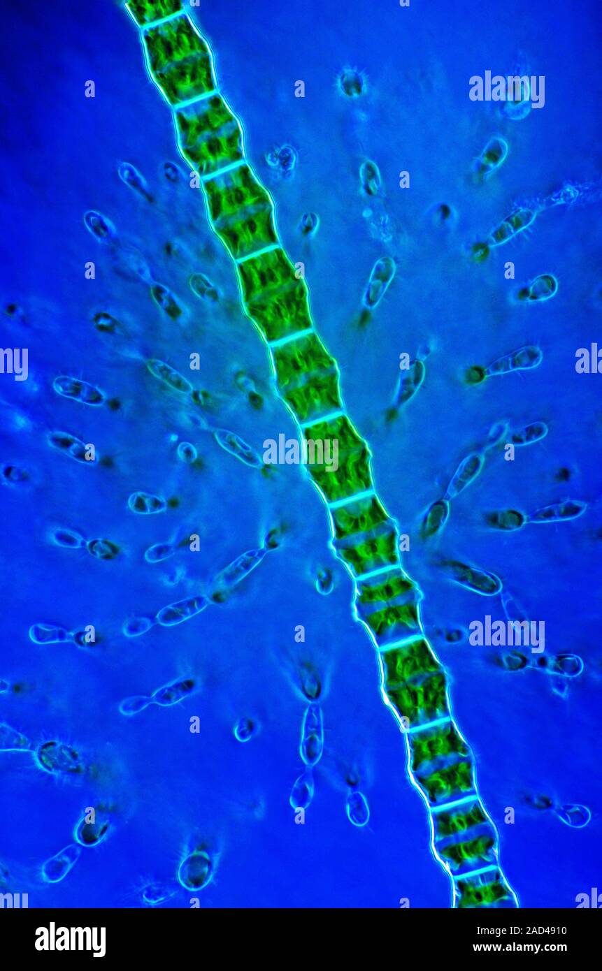 Desmid and red algae. Darkfield illuminated polarised light micrograph ...