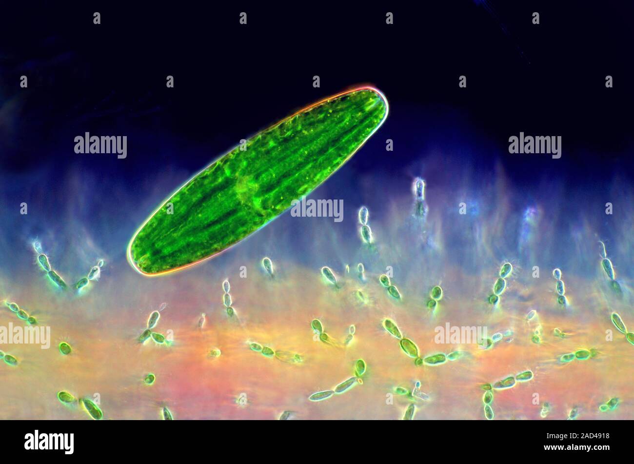 Desmid and red algae. Darkfield illuminated polarised light micrograph ...